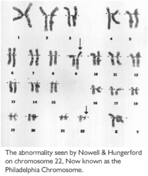 The Philadelphia Chromosome | OncoLink